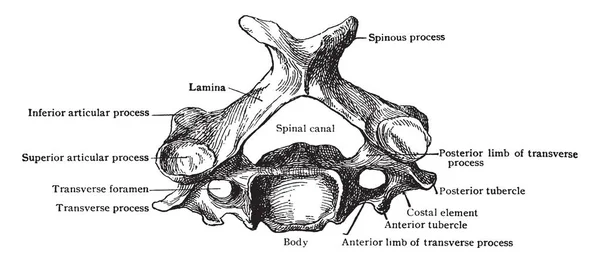 Bifurcated Spinous Process