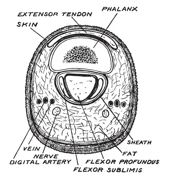 Leech Cross Section