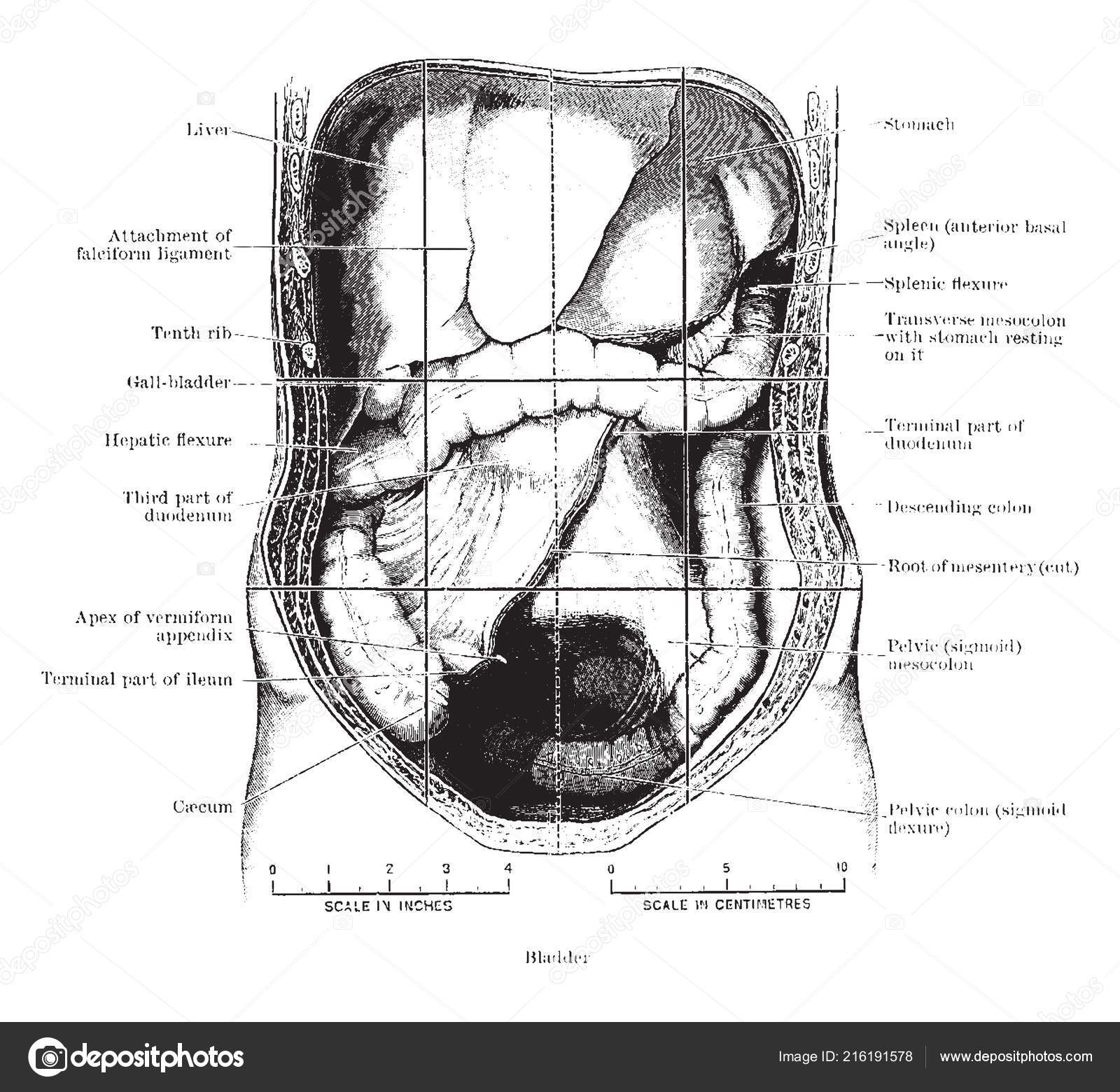 Diagram Represents Abdomen Laid Open Removal Jejunum Ileum Vintage Line ...