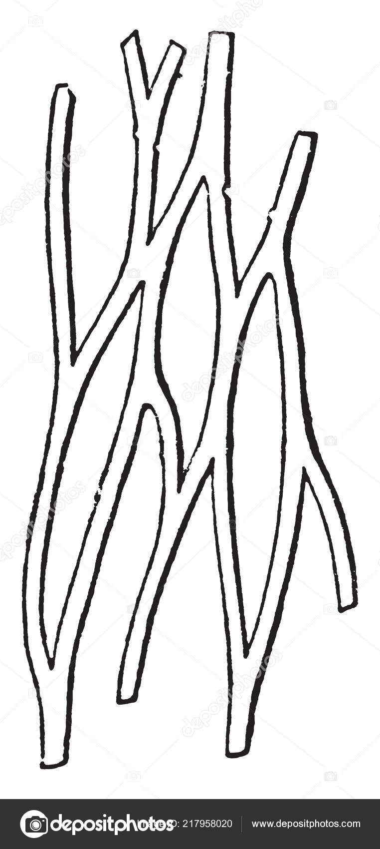 Presently Production Ordinay Connective Tissue Fibers Two Kinds Make ...