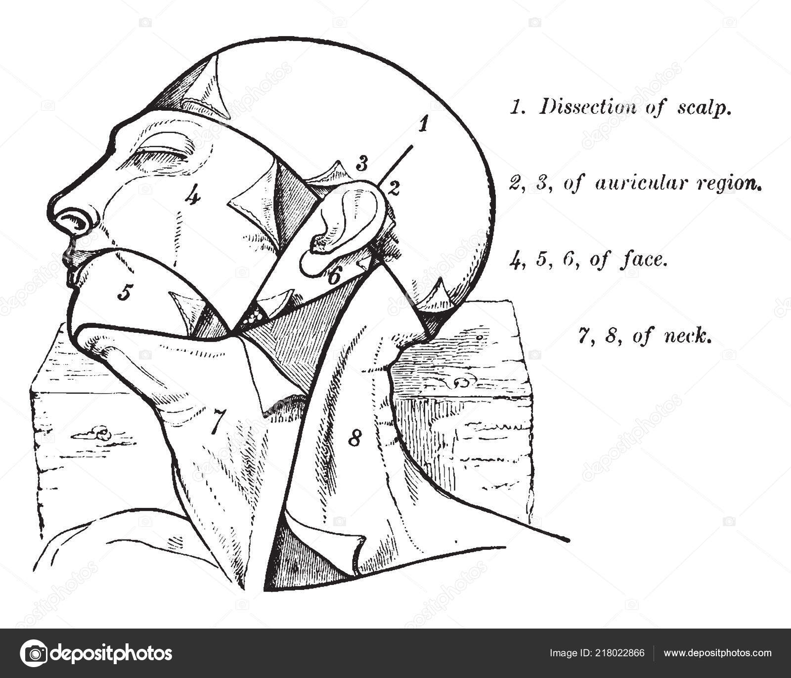 Dissection Head Face Neck Vintage Line Drawing Engraving Illustration ...