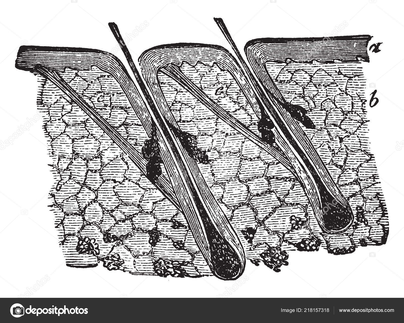 Illustration Represents Section Skin Showing Hairs Sebaceous Glands ...