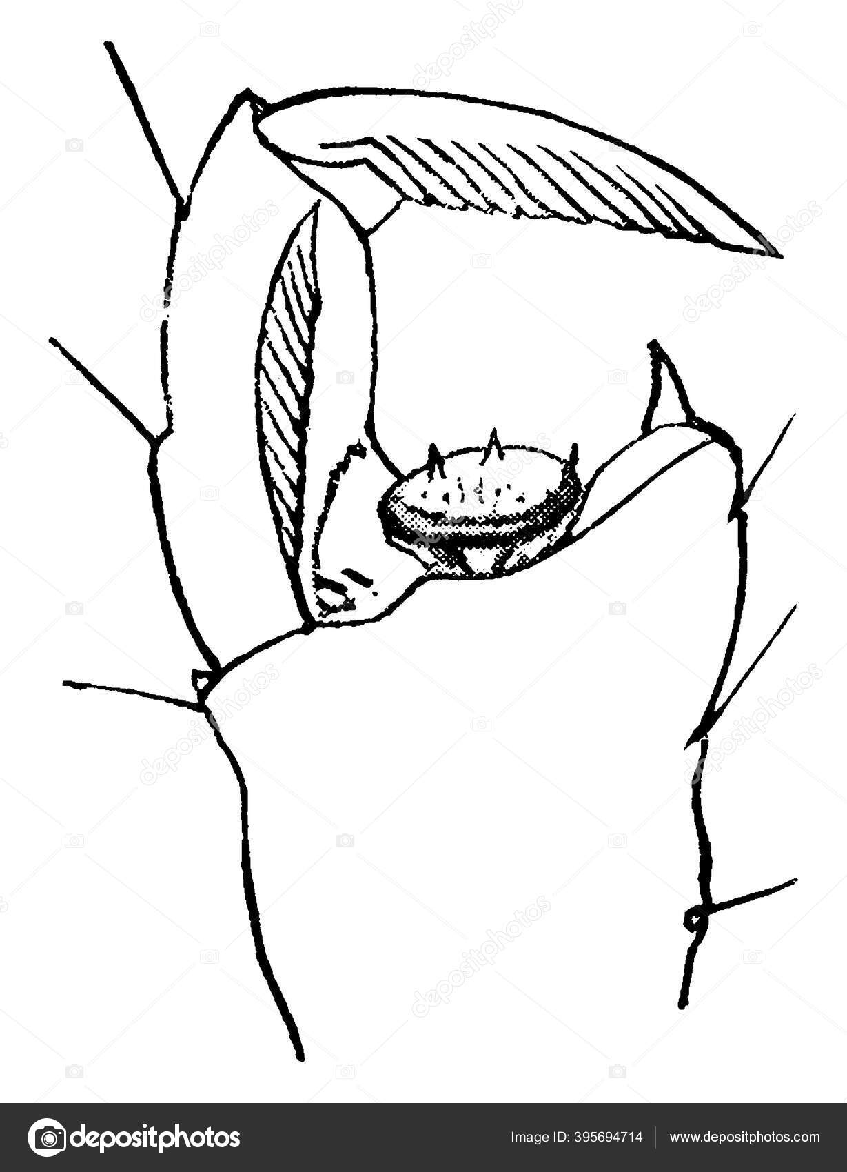 Image Showing Detailed View Scansorial Claw Hog Louse Hermatopinus ...