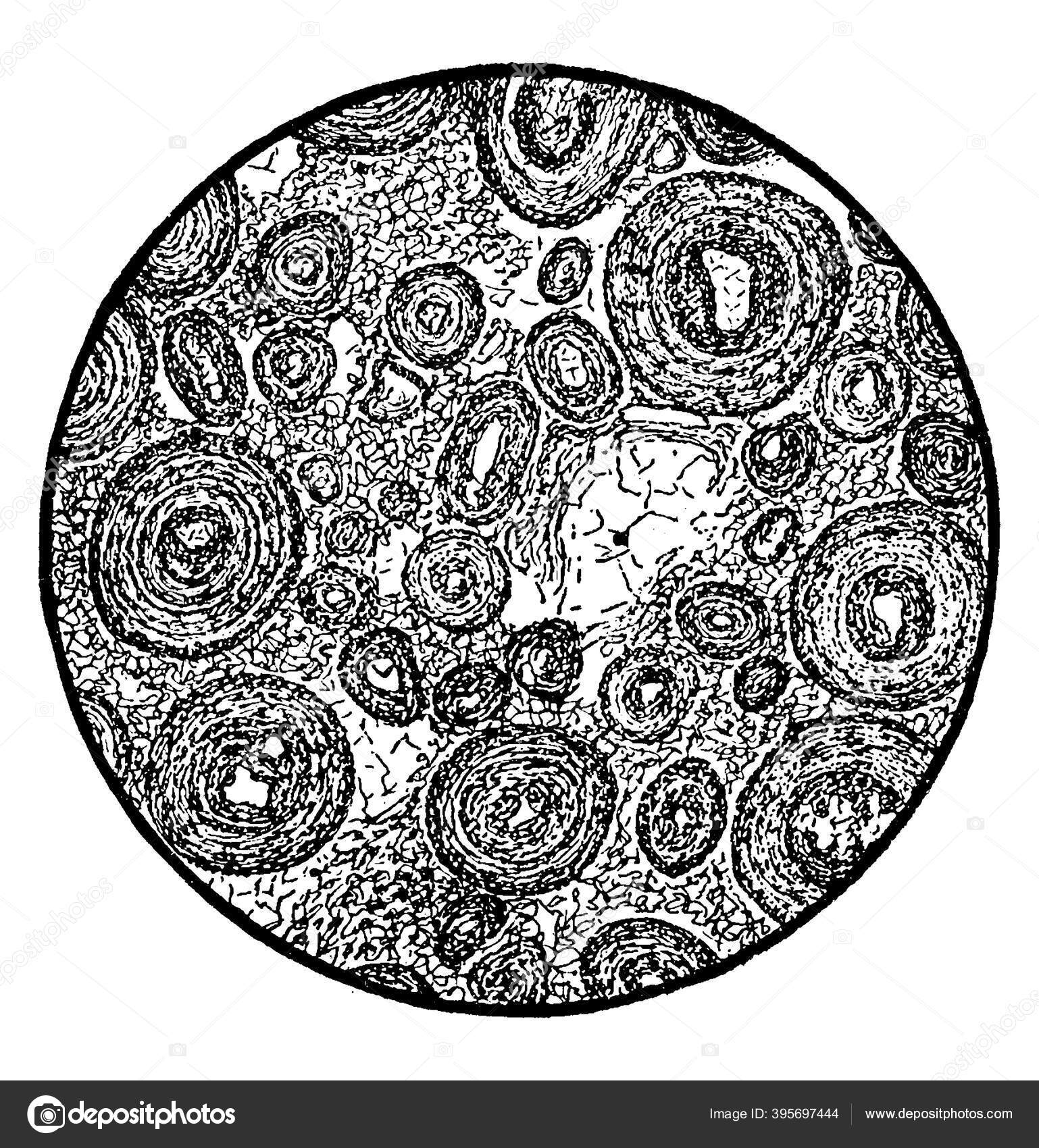 Diagram Shows Jurassic Oolite Oolite Sedimentary Rock Formed Ooids ...