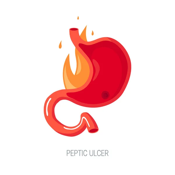 Peptic ulcer Vector Art Stock Images | Depositphotos