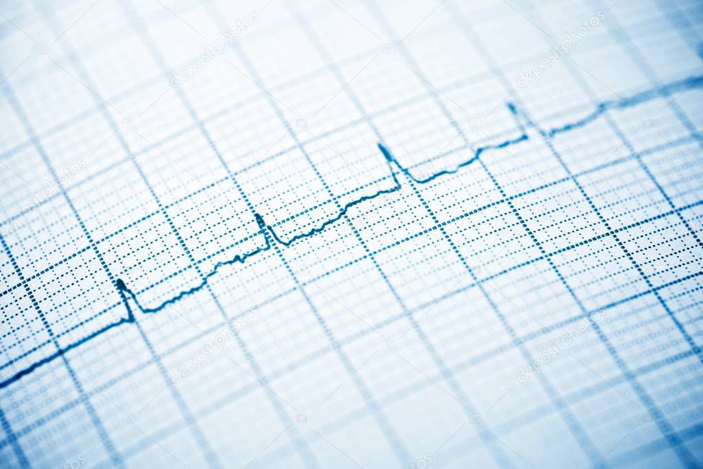 Primer plano de un electrocardiograma en forma de papel. 2024