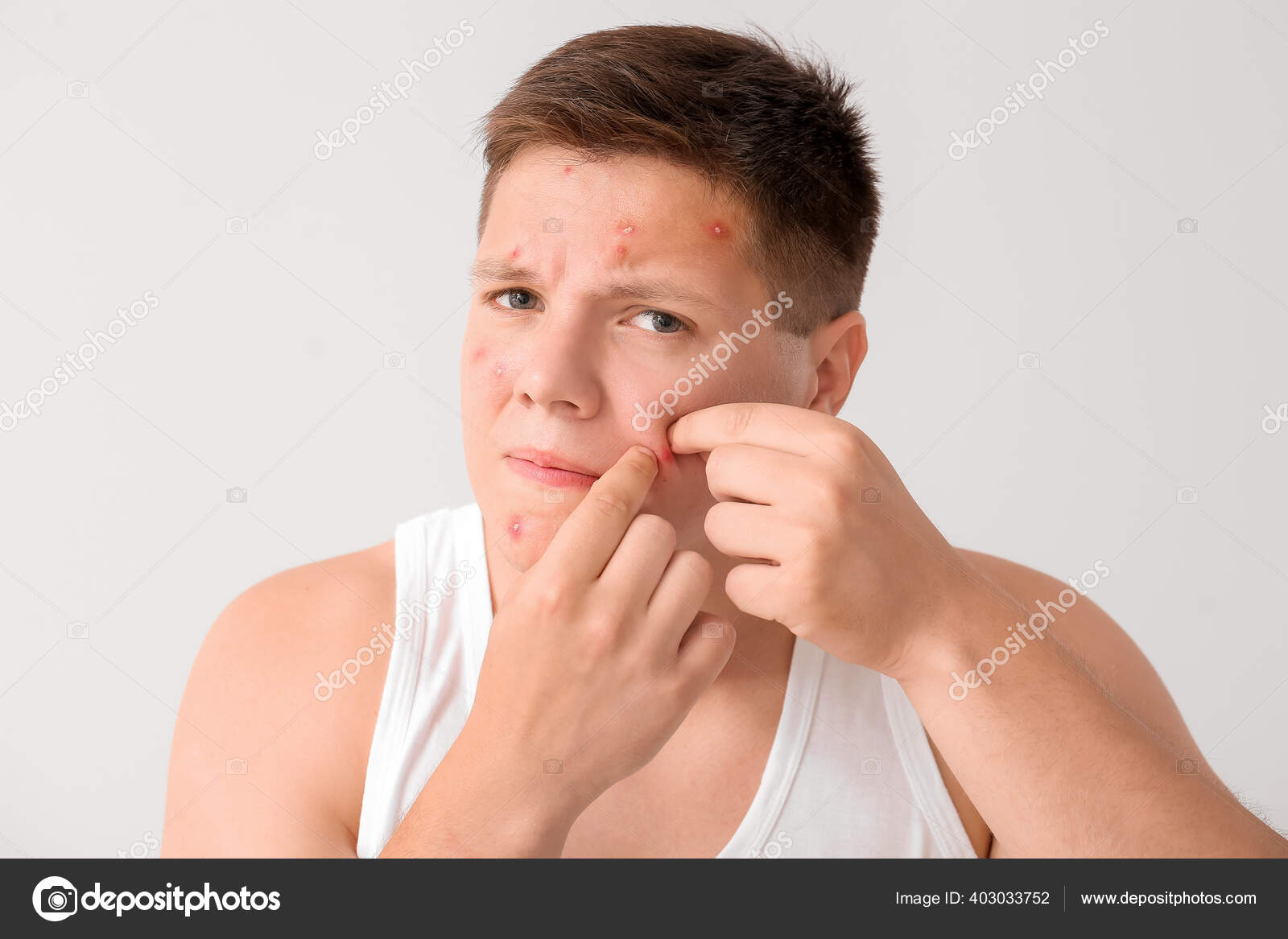 Teenage Boy Acne Problem Squishing Pimples Light Background Stock Photo ...