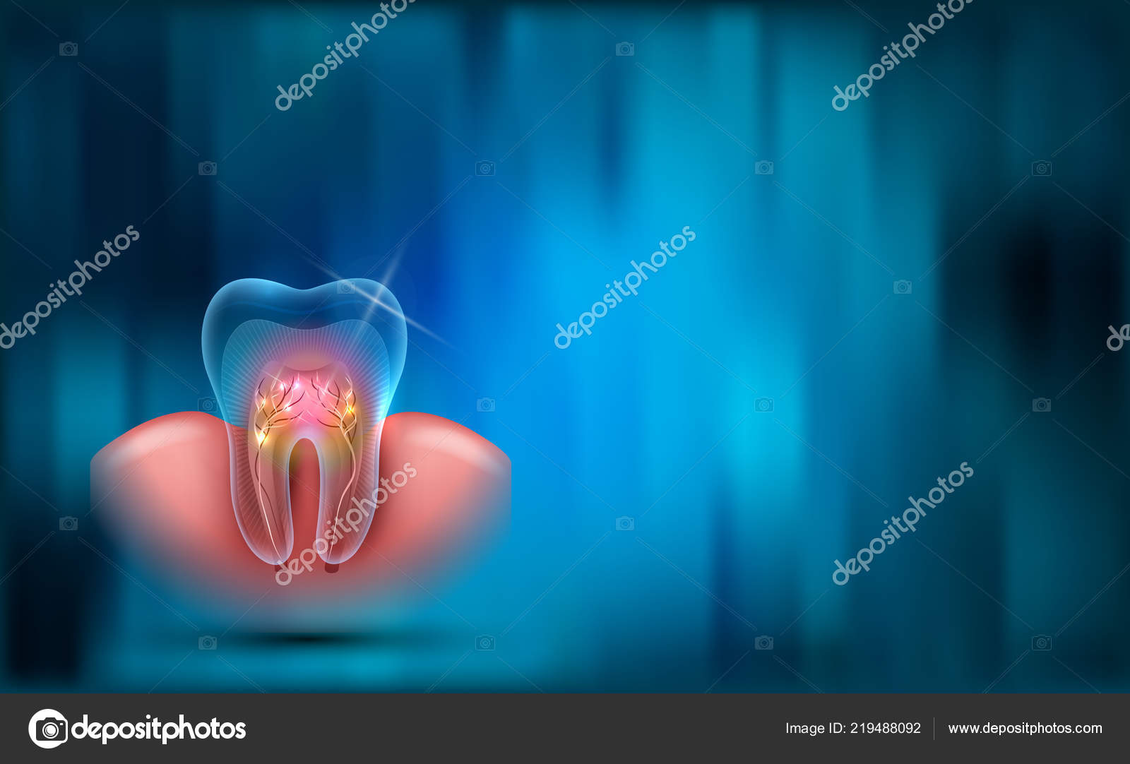 Fondo Dental Sección Transversal Transparente Los Dientes Raíces Encías ...
