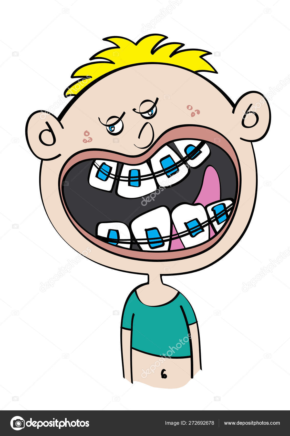 Funny white boy with dental braces cartoon Stock Vector Image by ...
