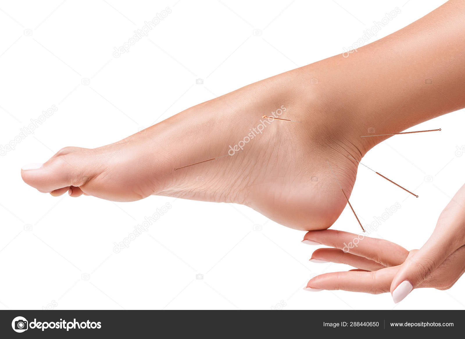Female legs with insert acupuncture needles. Stock Photo by ©kotin ...