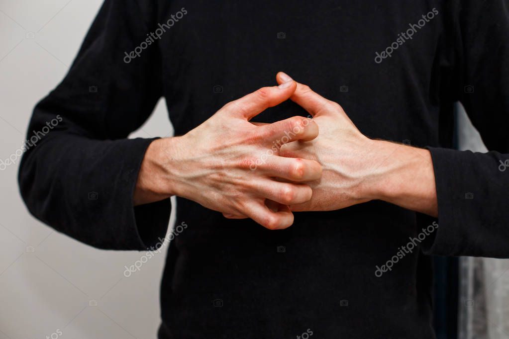 El hombre se rasca a sí mismo, la piel seca escamosa en la mano con ...