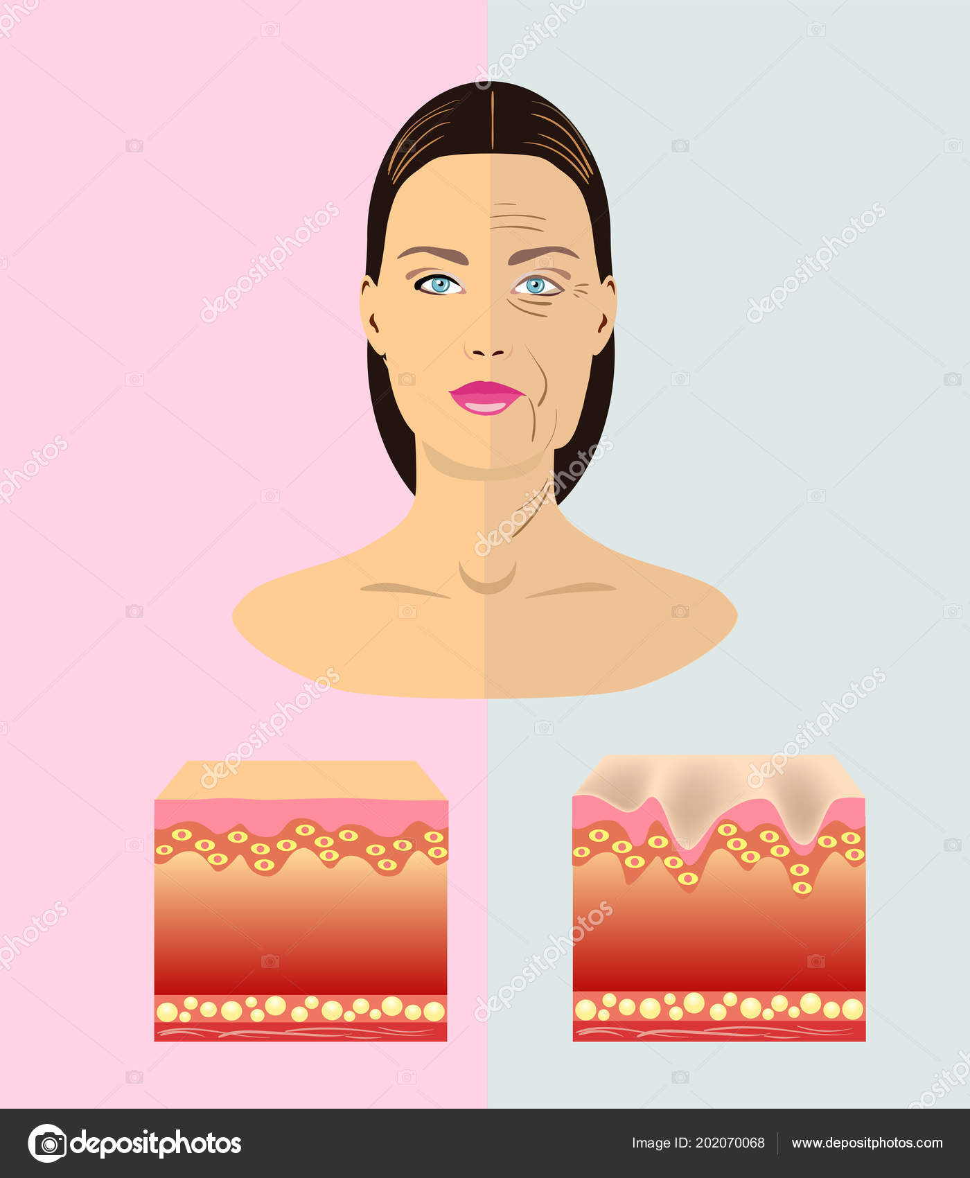La différence entre peau jeune et peau âgée, illustration vectorielle Vecteur par ©bemoll 202070068
