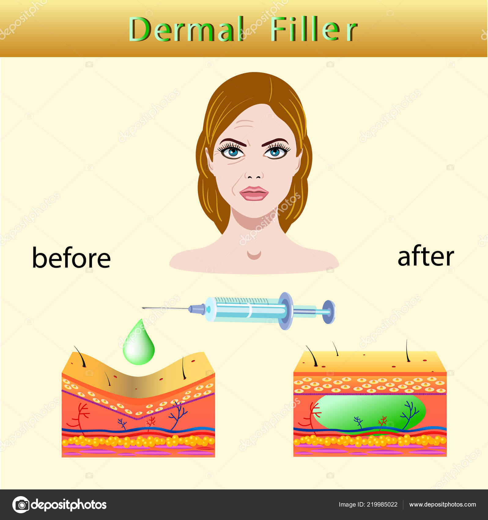 Filler Clip Art Backgrounds