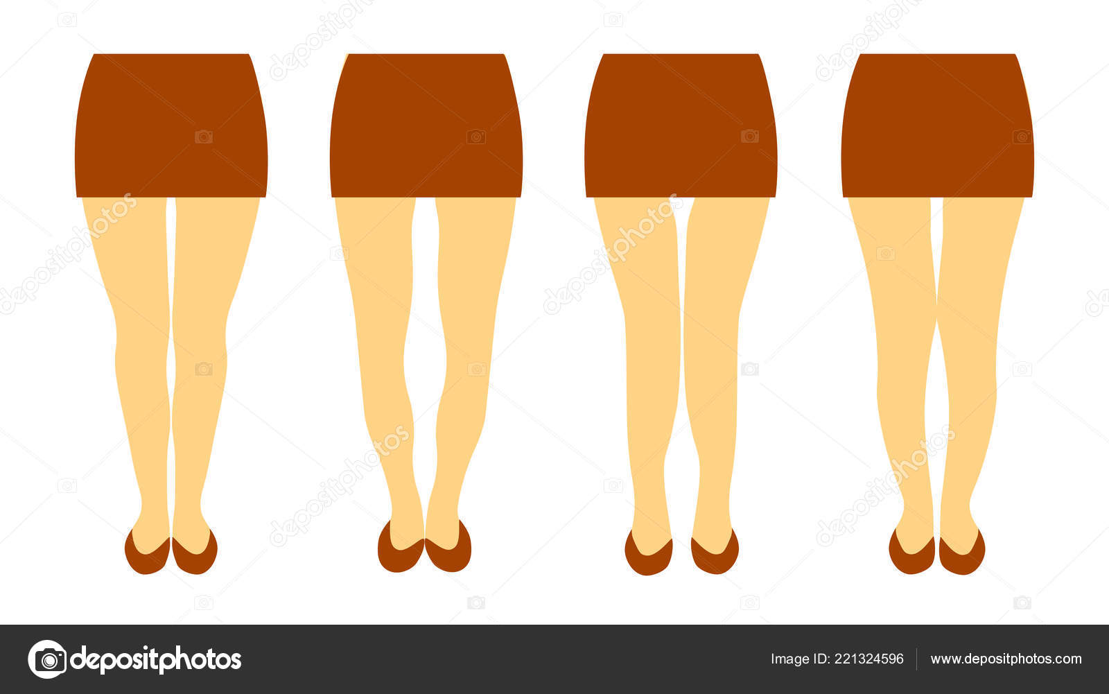 Vector illustration with different shapes of women legs Stock Vector ...