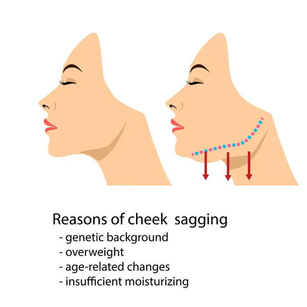 123 Double chin Vector Images | Depositphotos