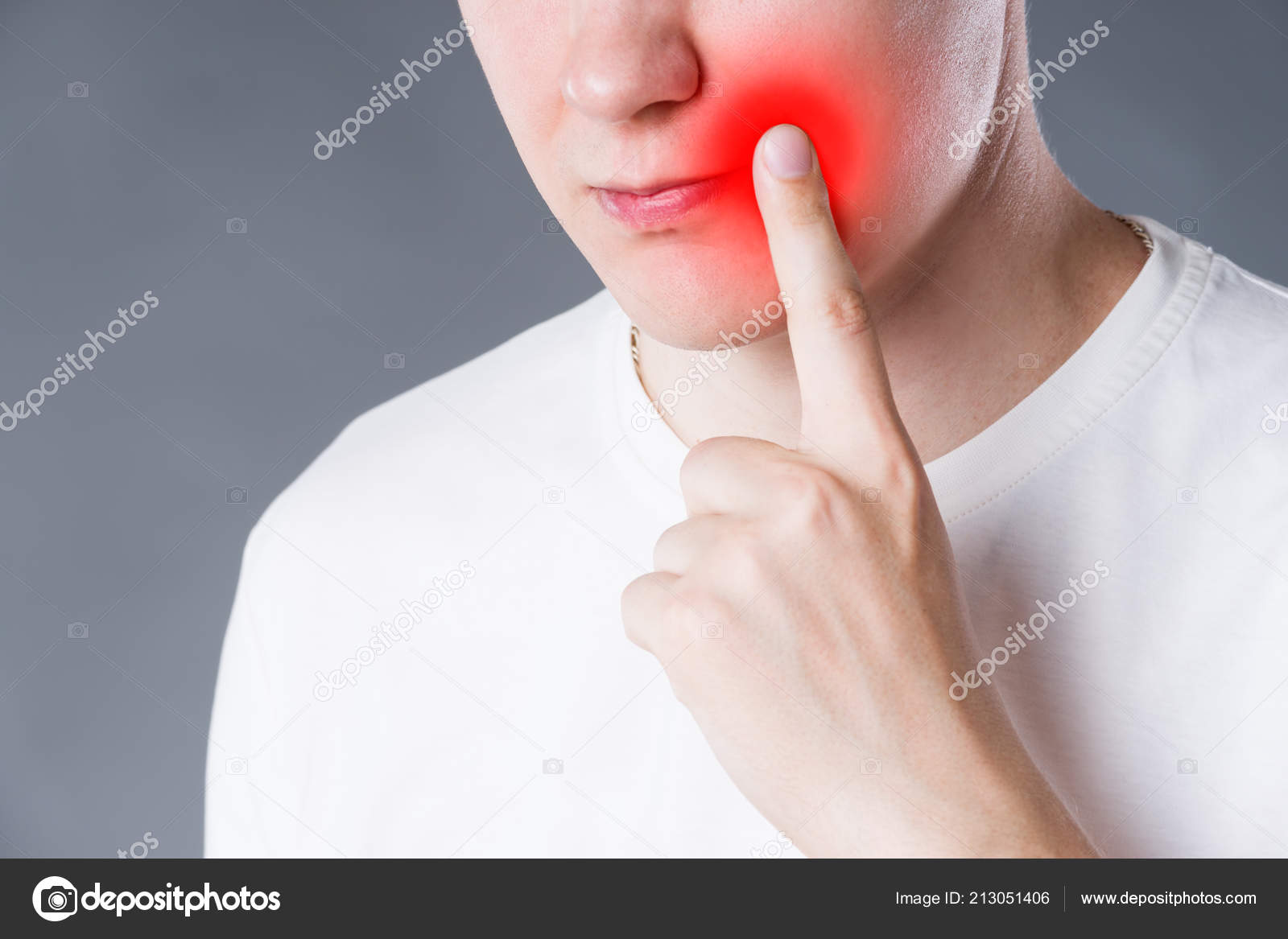 Herpes Throat Pictures