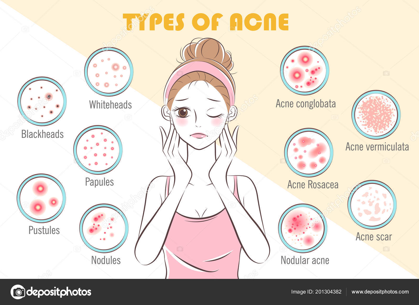 Girl Types Acne Yellow Background Stock Vector Image by ©estherqueen999 ...