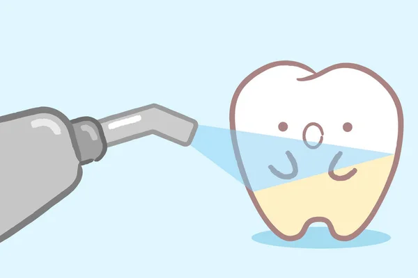 Laser tooth Vector Art Stock Images | Depositphotos