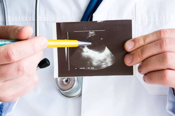 Pluma con punta Stock Photos, Royalty Free Pluma con punta Images ...