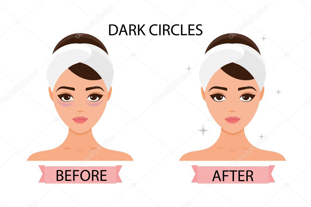 La chica tiene ojeras en la cara. Antes y después. Concepto de cuidado ...