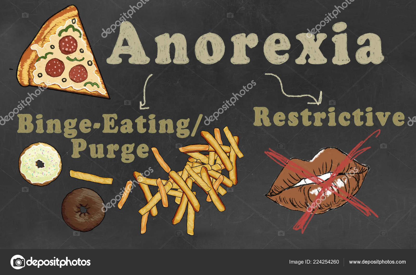Anorexia Illustrated Classification Two Types Binge Eating Purge ...