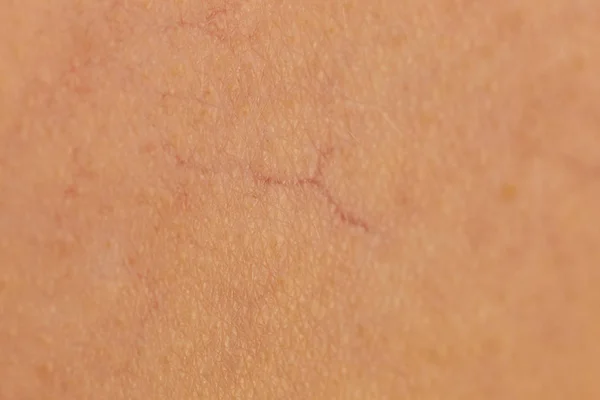 Persona que tiene dermatosis en la piel. Concepto de problemas de ...