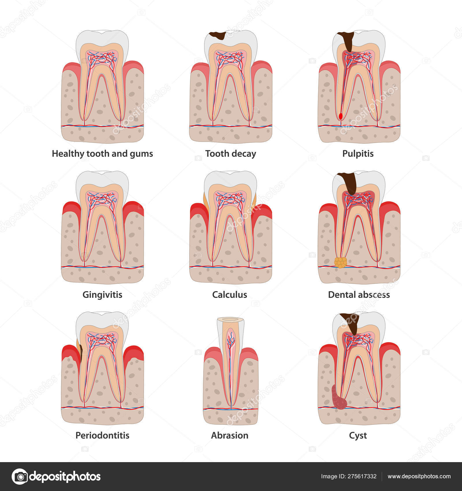 Popular teeth diseases icons in flat design, vector medical ...