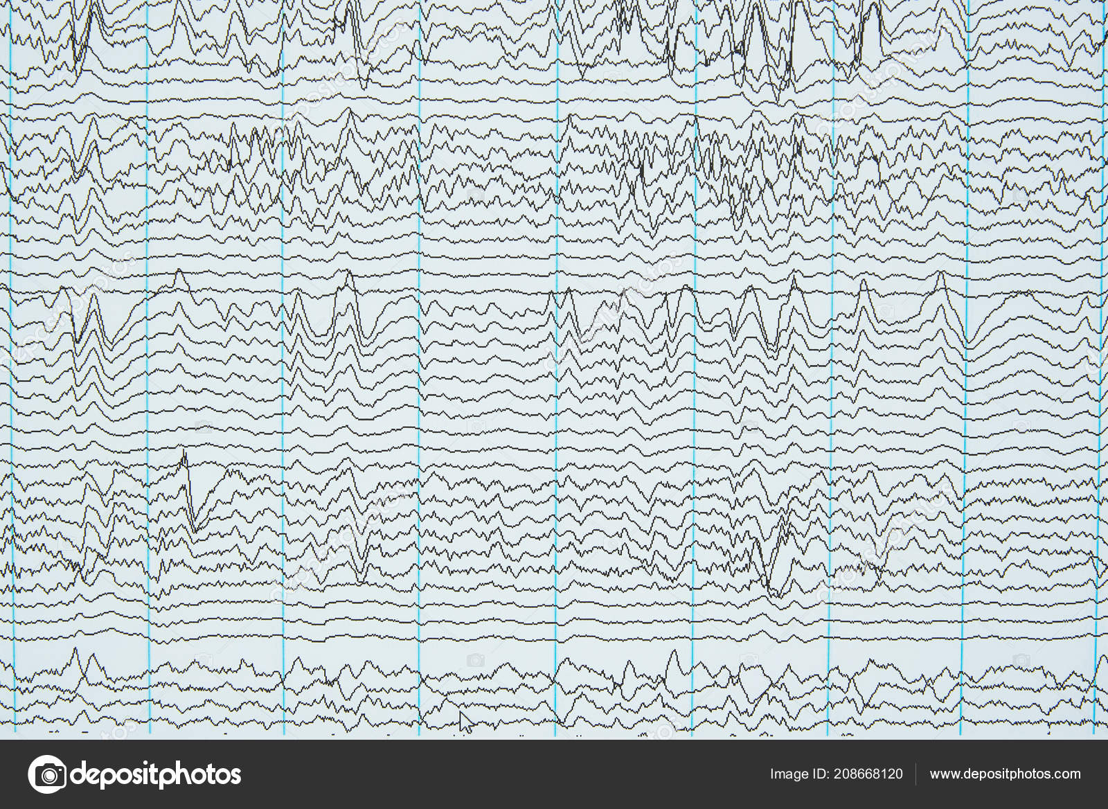 Imaging Brain Waves Electroencephalography Eeg Human Stock Photo by ...