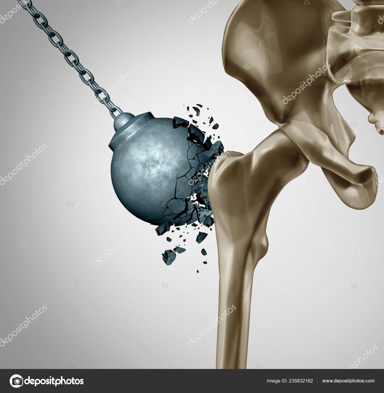 Strong Bones Healthy Human Bone Orthopedics Strength Mineral Density ...