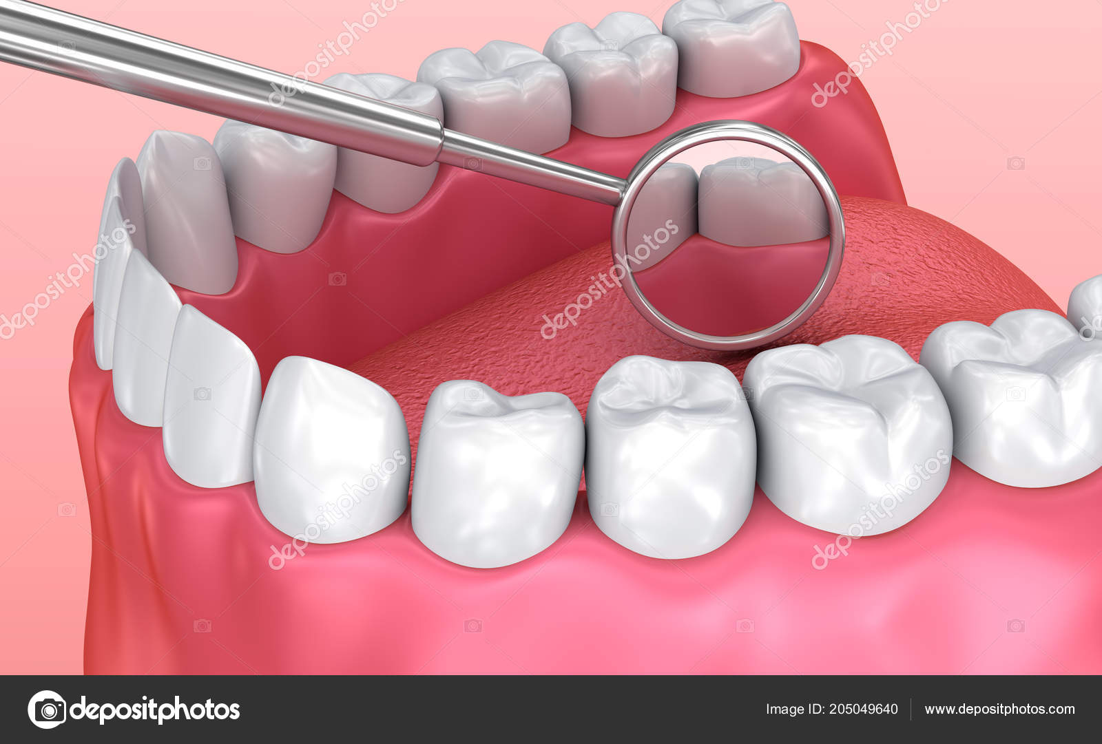 Teeth Inspection Mirror Medically Accurate Tooth Illustration Stock ...