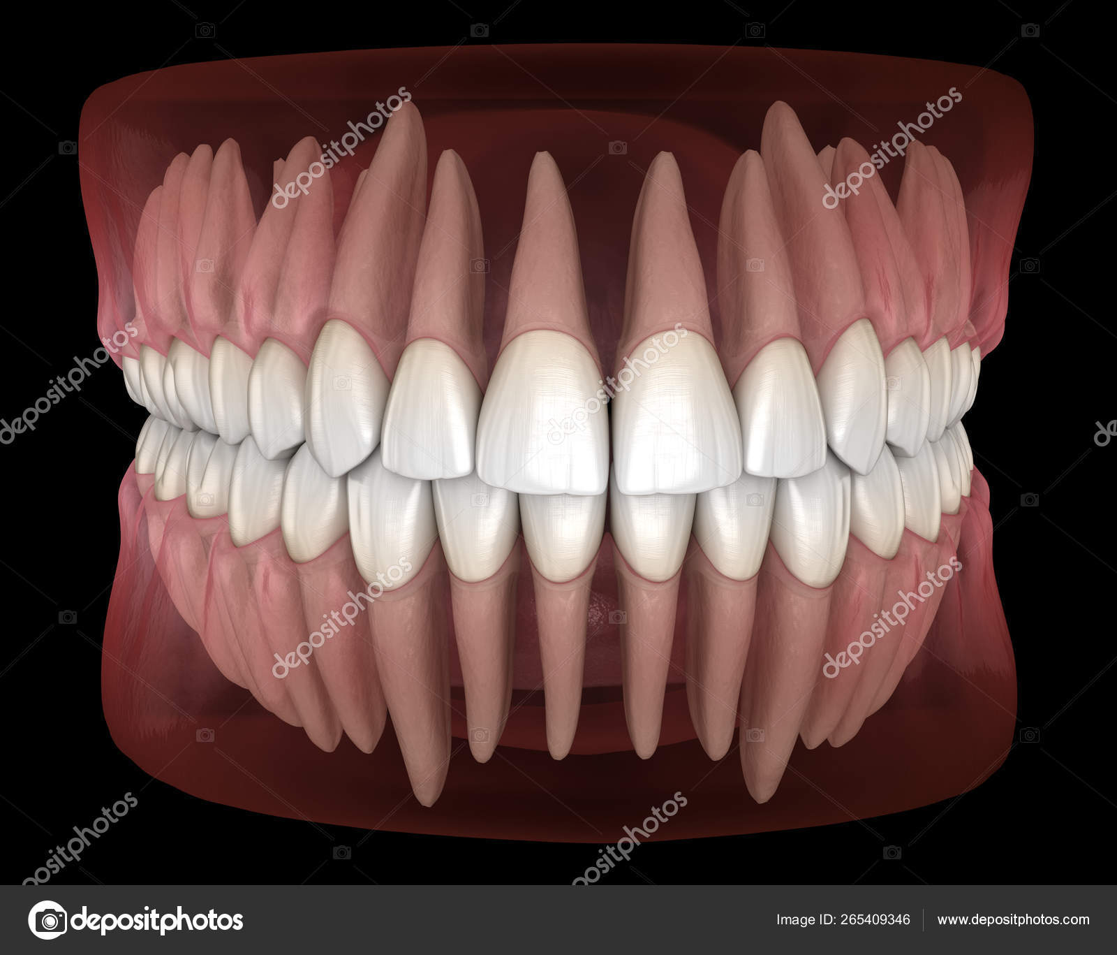 Morphology Mandibular Maxillary Human Gum Teeth Medically Accurate ...