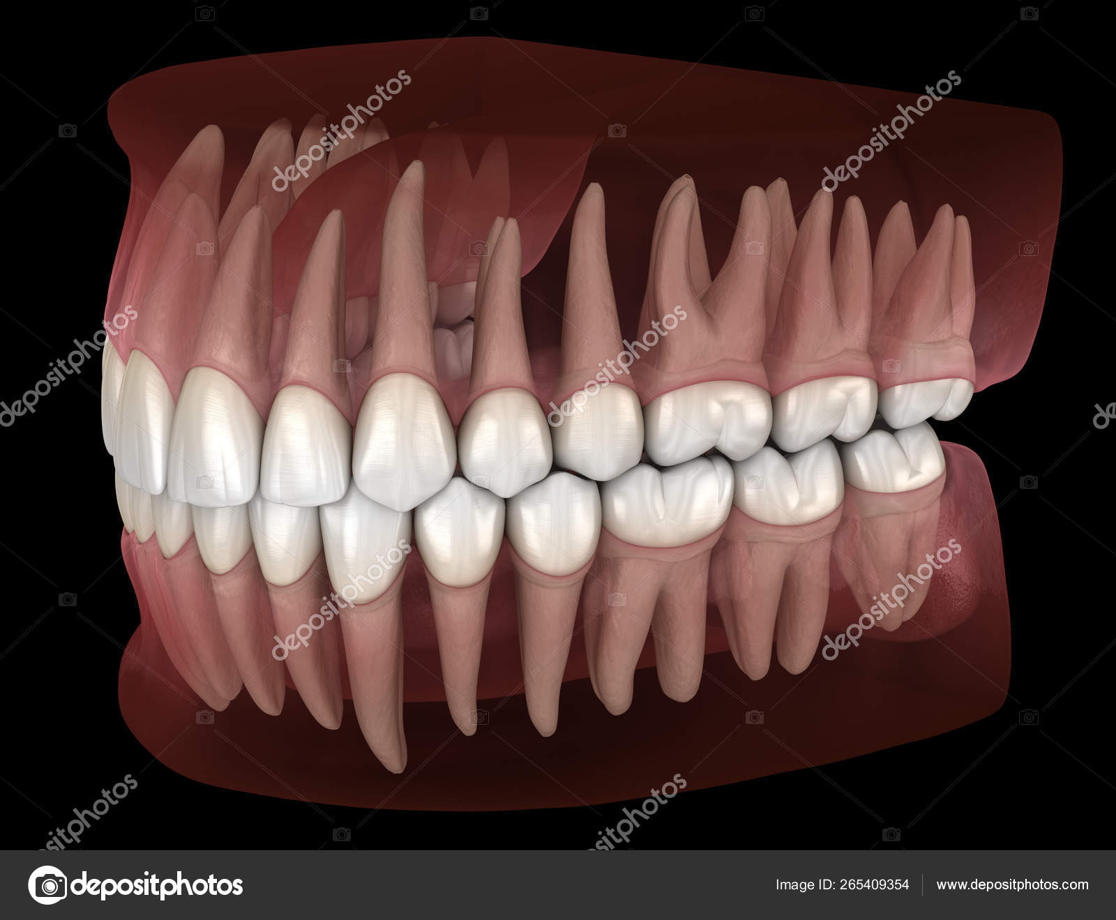 Where Is The Canine Tooth On A Human