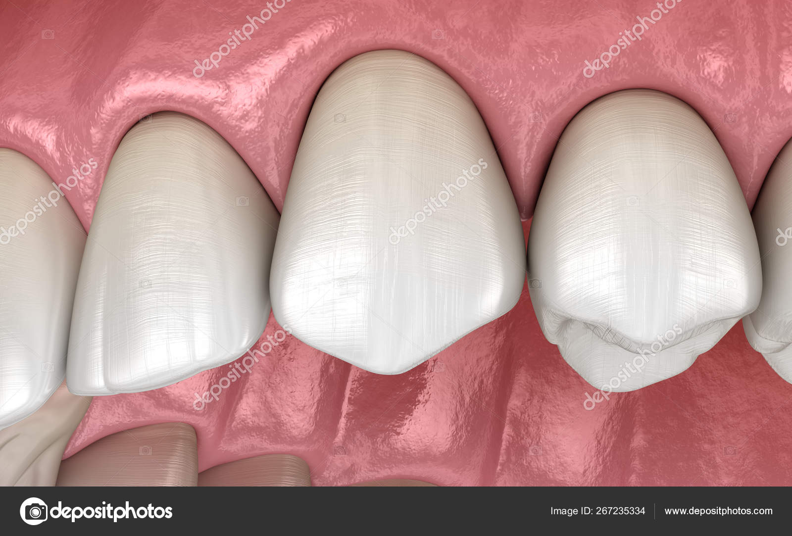 Maxillary Human Gum Teeth Medically Accurate Tooth Illustration Stock ...