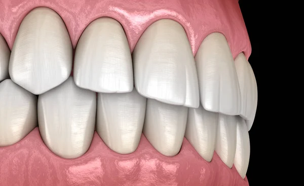 Healthy human teeth with normal occlusion, side view. Medically ...