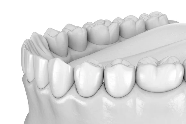 Cad teeth Stock Photos, Royalty Free Cad teeth Images | Depositphotos