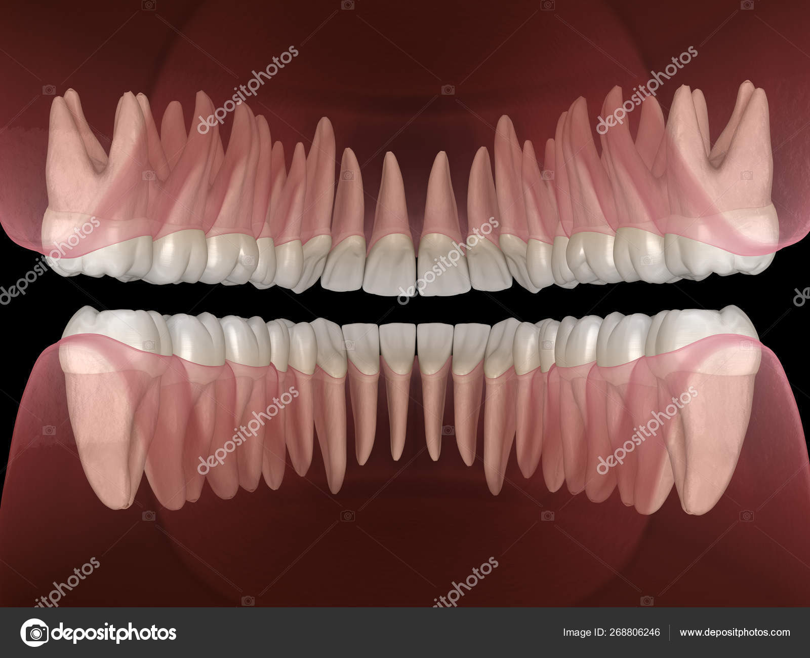 Morphologie Des Gencives Des Dents Humaines Mandibulaires Maxillaires ...