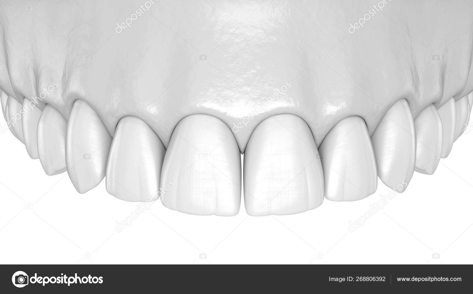 Anatomie Mandibulaire Des Gencives Des Dents Humaines Illustration ...