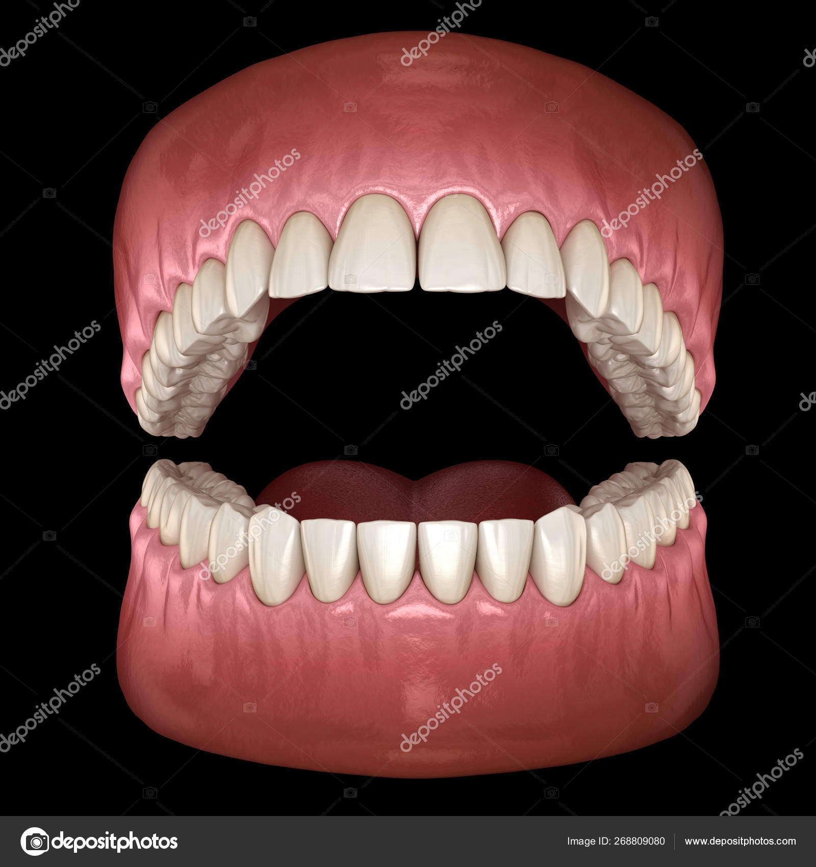 Dental Anatomy Opened Dentures Medically Accurate Dental Illustration ...