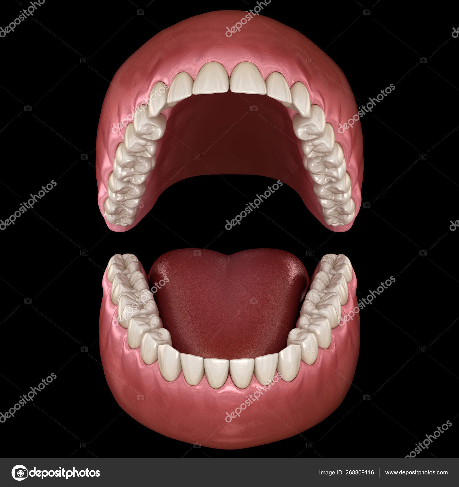 Dental Anatomy Opened Dentures Medically Accurate Dental Illustration ...
