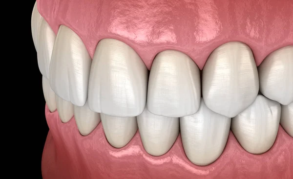 Healthy human teeth with normal occlusion, side view. Medically ...