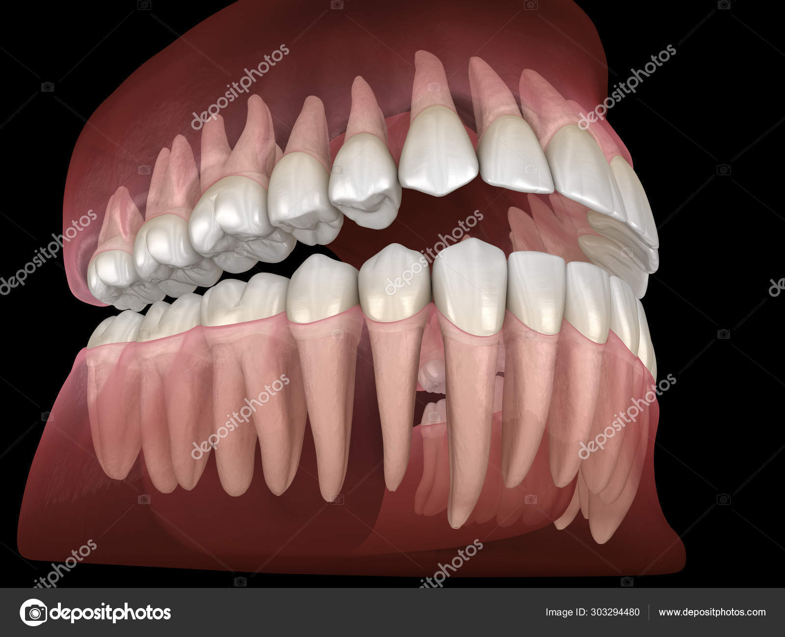 Morphology Mandibular Maxillary Human Gum Teeth Medically Accurate ...