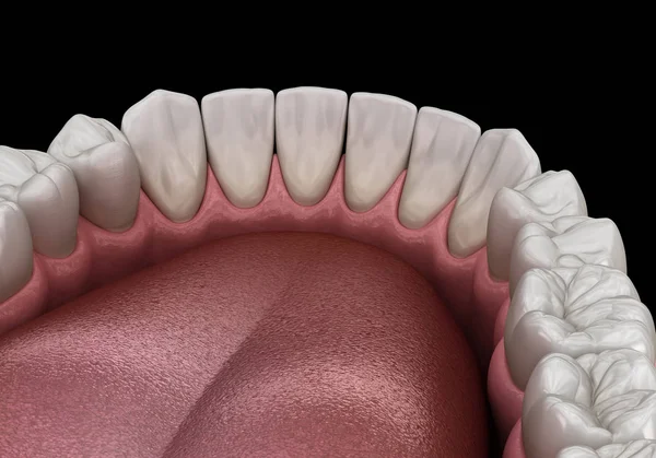 Mandibular Human Gum Teeth Anatomy Medically Accurate Tooth ...