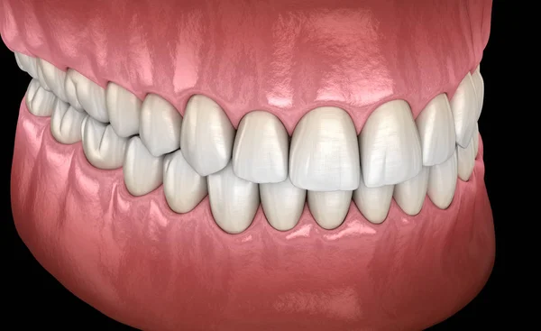 Morphology Mandibular Maxillary Human Gum Teeth Medically Accurate ...