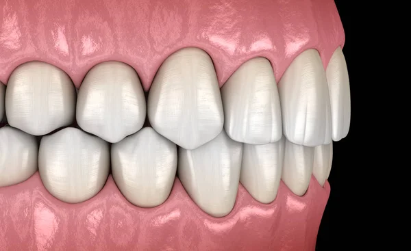 Healthy Human Teeth Normal Occlusion Side View Medically Accurate Tooth ...