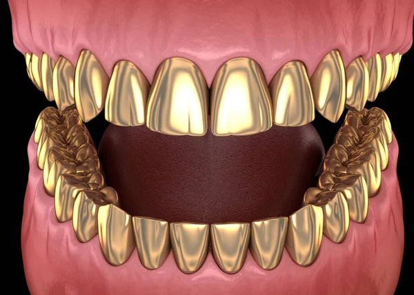 Gold teeth Stock Photos, Royalty Free Gold teeth Images | Depositphotos