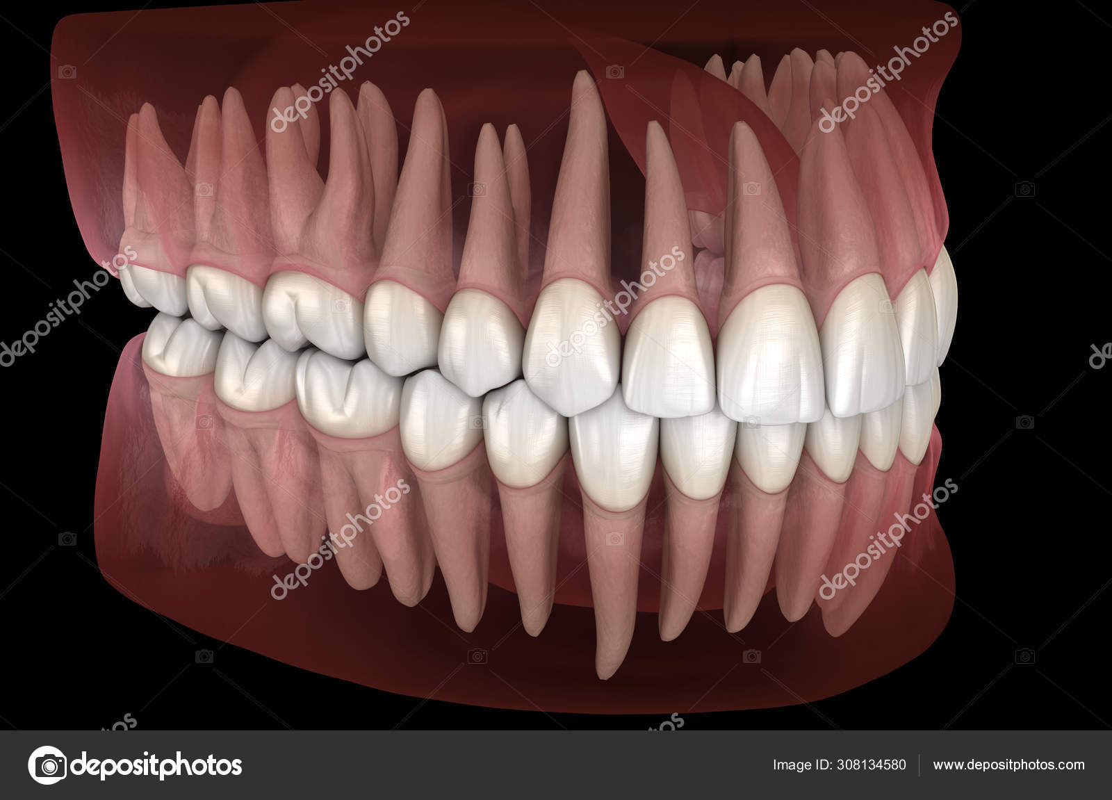 Morphology Mandibular Maxillary Human Gum Teeth Medically Accurate ...