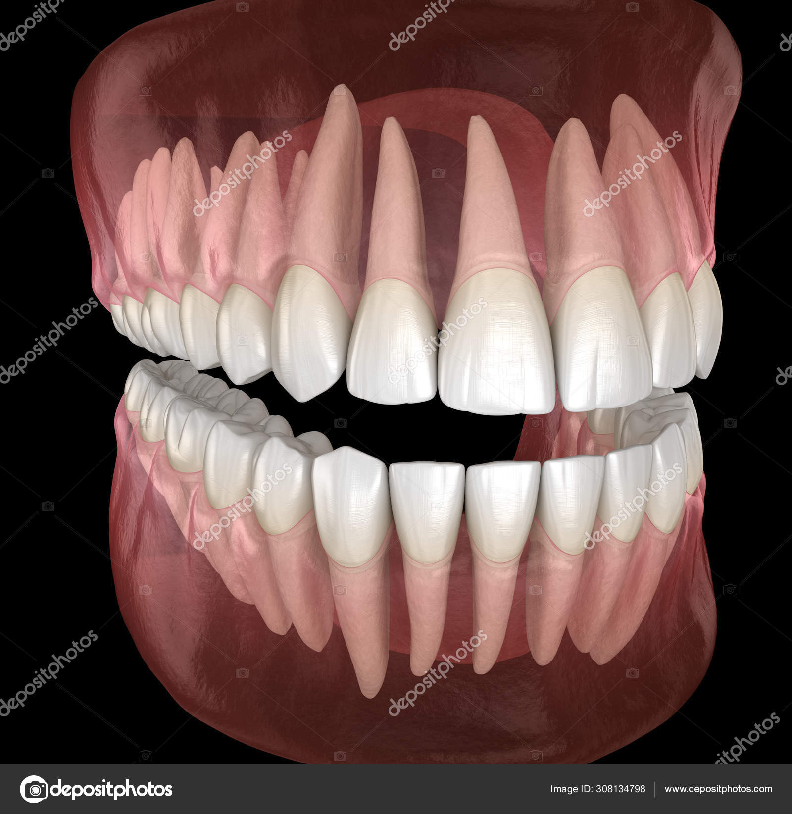 Morphologie Des Gencives Des Dents Humaines Mandibulaires Maxillaires ...