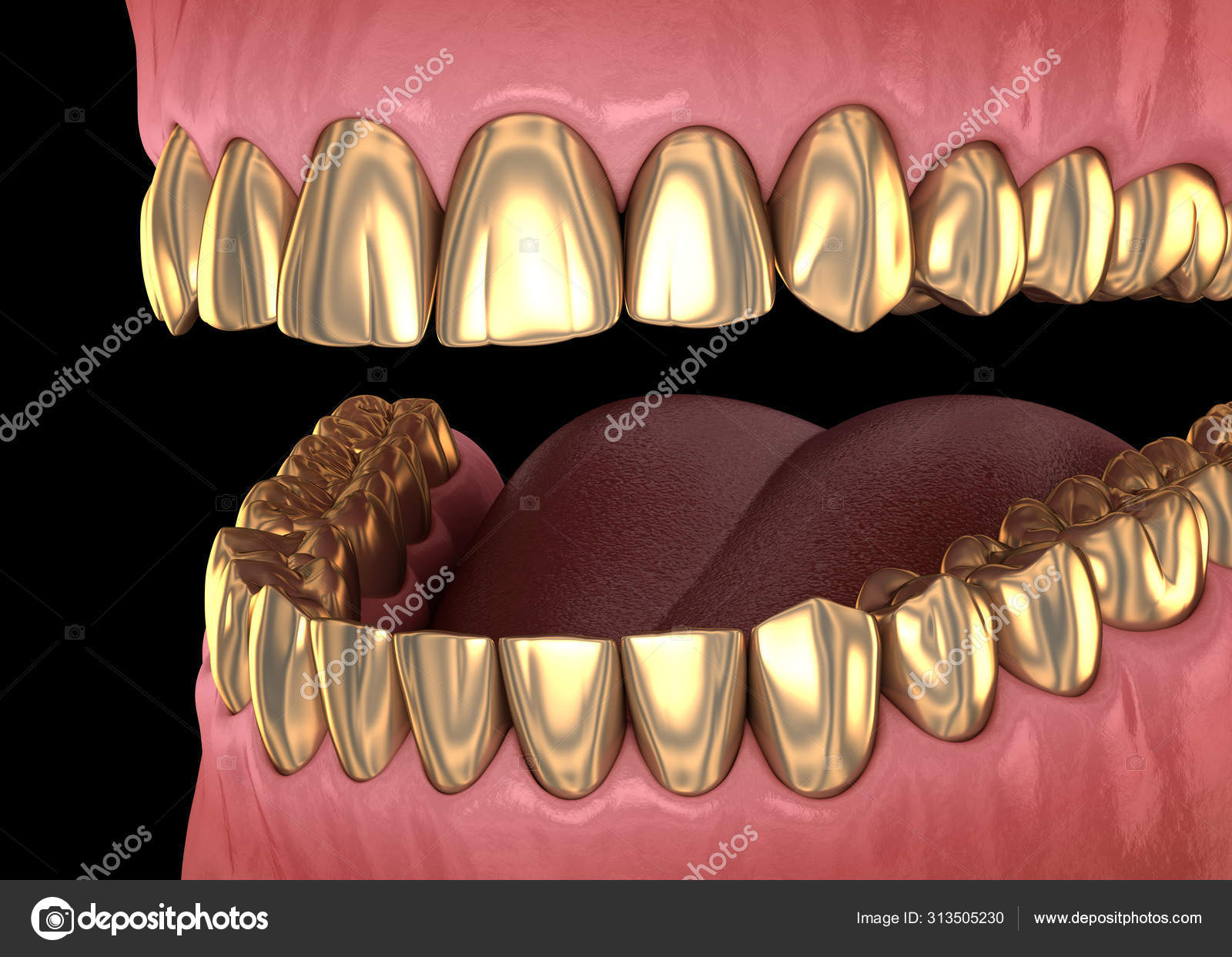 Humans With Natural Fangs