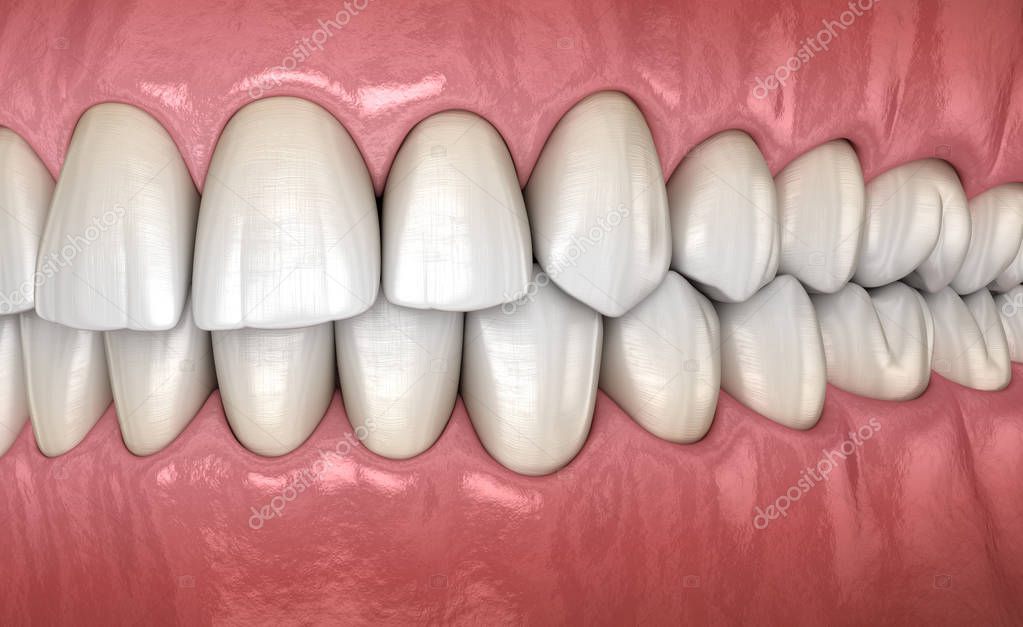 Healthy Human Teeth Normal Occlusion Side View Medically Accurate Tooth ...