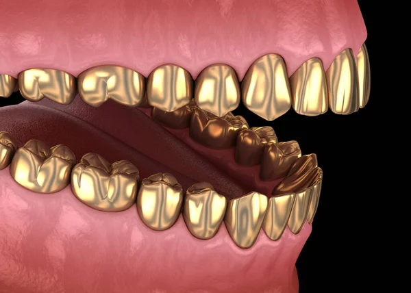 Gold teeth Stock Photos, Royalty Free Gold teeth Images | Depositphotos